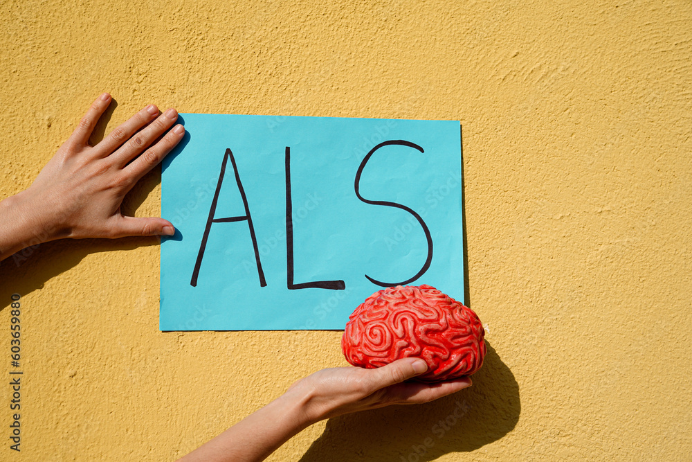 ALS (Amyotrophic Lateral Sclerosis) acronym with a brain. Motor Neurone ...