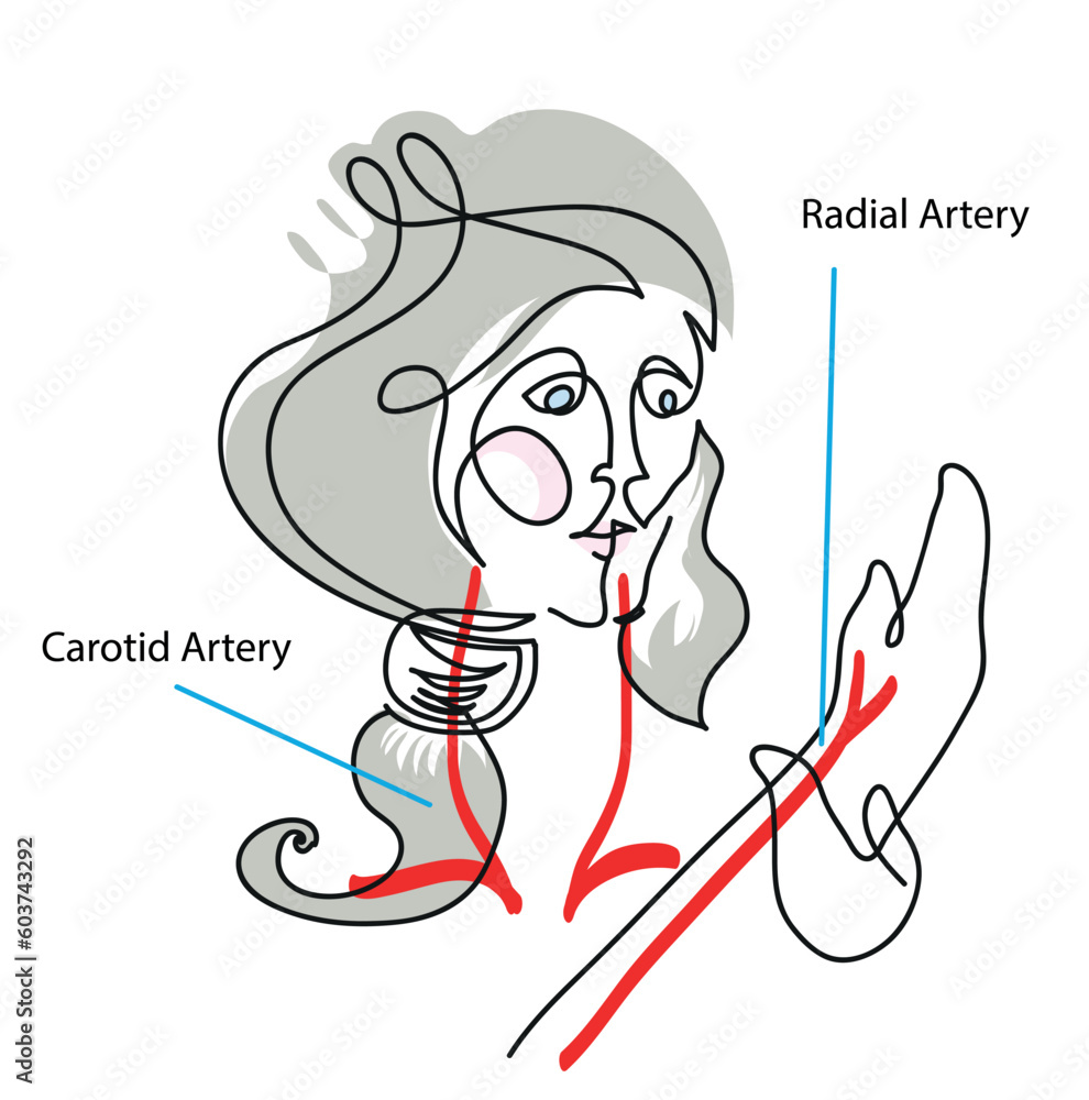 One line drawing of radial artery and carotid artery illustration. One ...