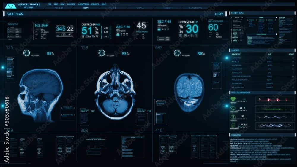 Medical Profile of Patient Showing Head and Brain MRI Scan. Vital Signs ...