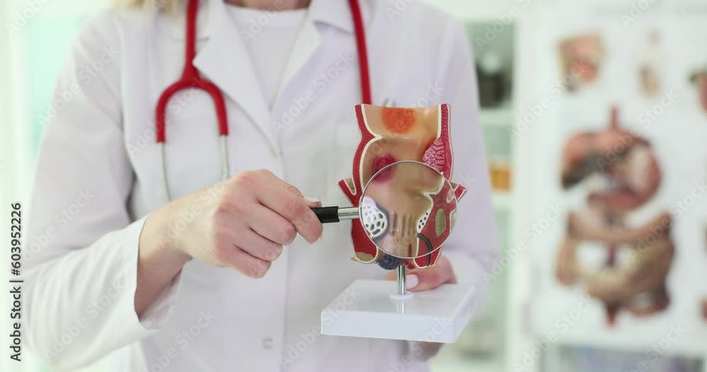 Proctologist is holding magnifying glass and anatomical model of rectum ...