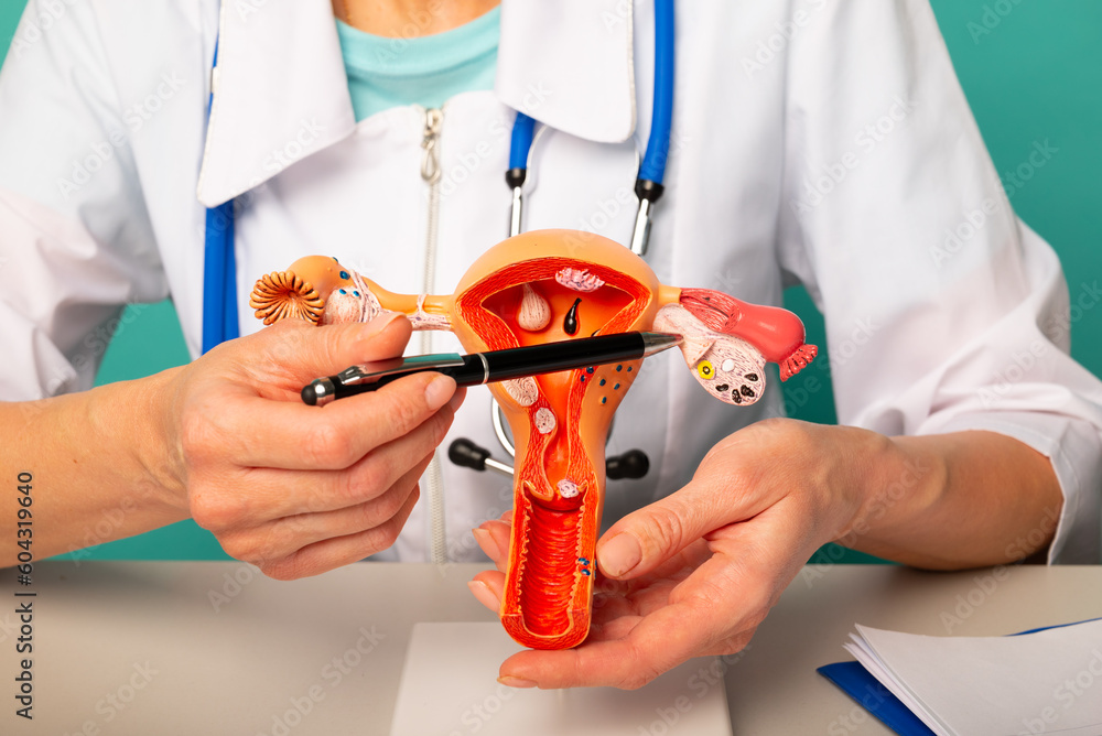 Doctor gynecologist showing pen on plastic model of uterus and ovaries ...