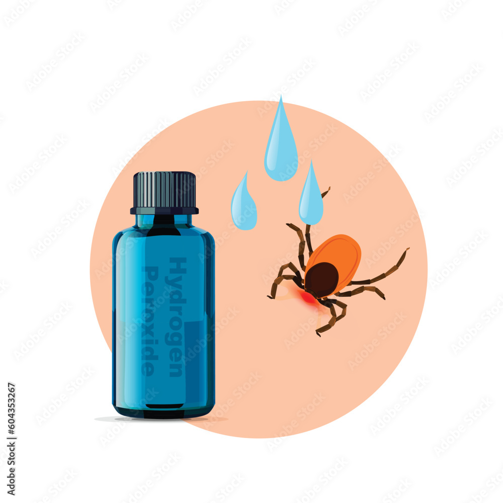 Removing encephalitis ticks after bite. How to remove mite. Parasite ...