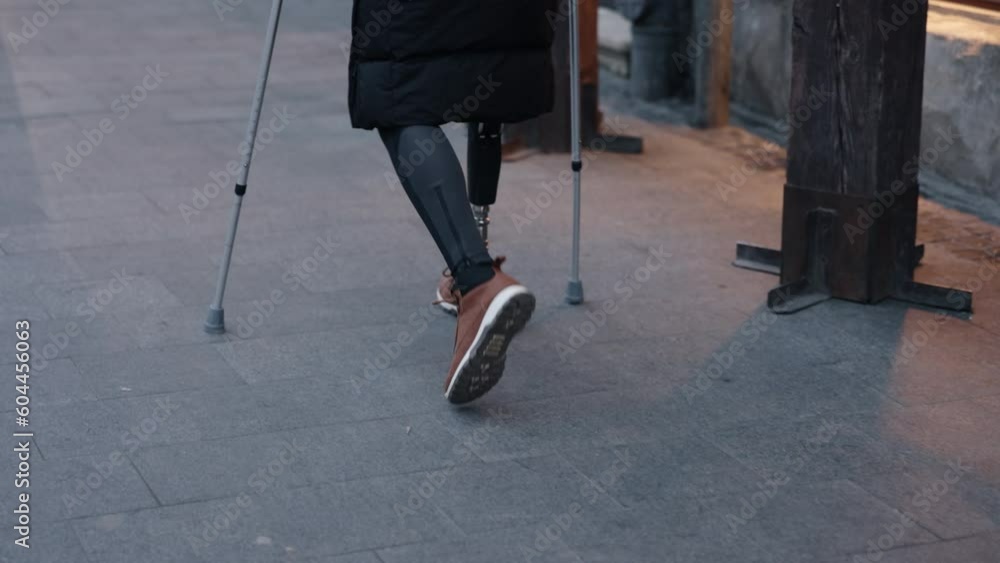 disabled person, artificial limb, physical impairment. Close-up ...