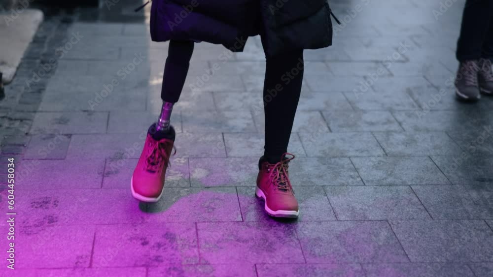 assistive device, leg amputation, artificial limb. Disabled young man ...