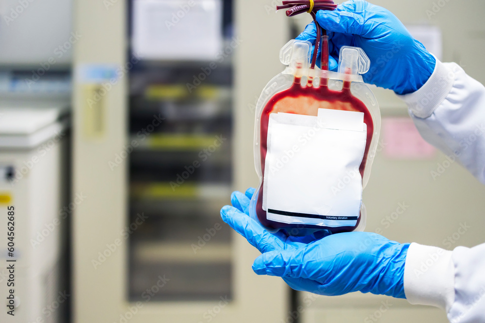 Leukocyte poor pack red cell in transfusion bag on a tray inside blood ...