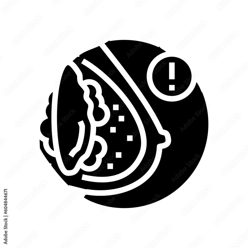 capsular contracture surgery glyph icon vector. capsular contracture ...