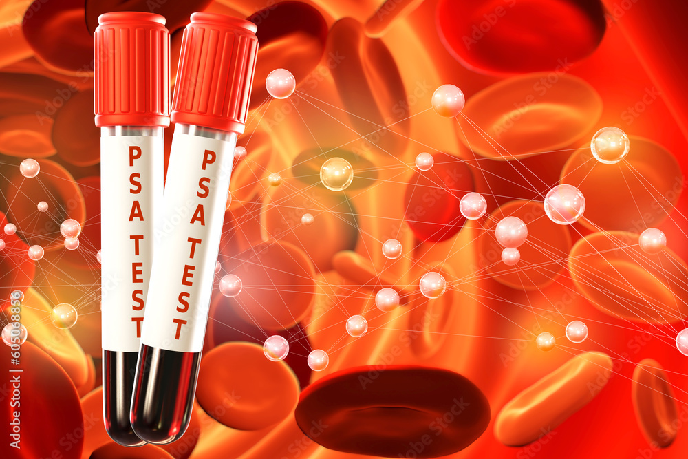 PSA test. Flasks near blood cells. Human organism. Science of ...