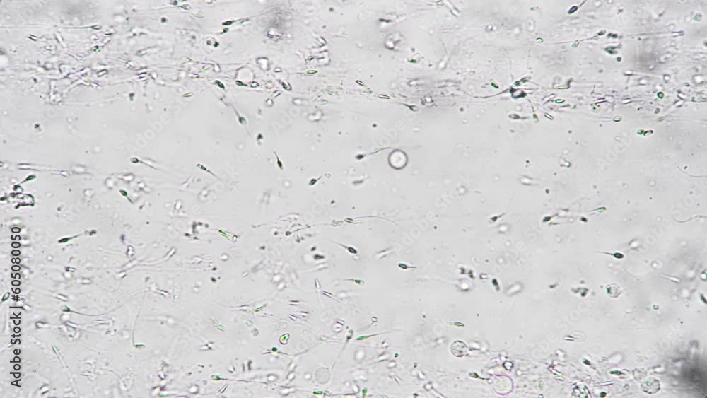 Vidéo Stock Sperm swim against flow of semen under microscope ...