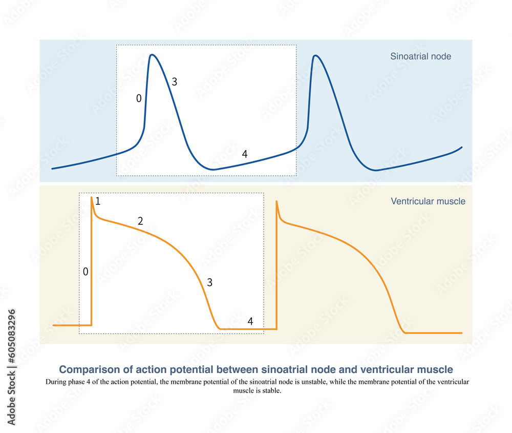 Pacing cells in the sinus node spontaneously produce electrical ...