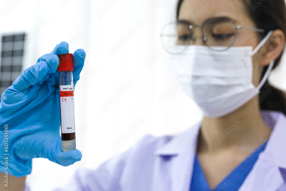 Scientist holding Coronavirus covid-19 infected blood sample tube DNA ...