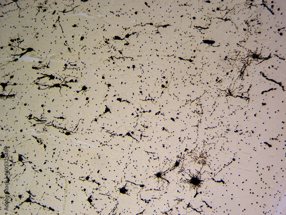 Brain Beauty: Golgi-Stained Cerebral Cortex at 100x Stock Photo | Adobe ...