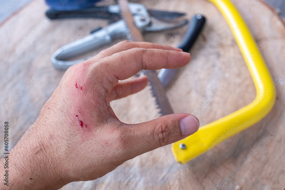Craftsman's hand with bleeding wound, Tool accident while working ...