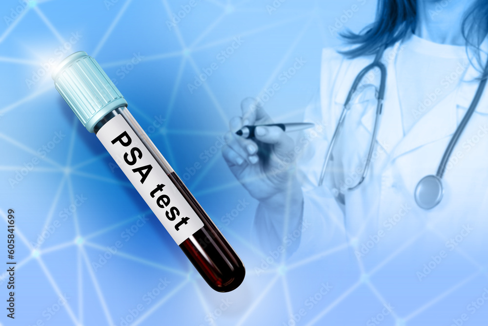 PSA test. Checking patient's blood. Tube with PSA logo. Diseases of ...