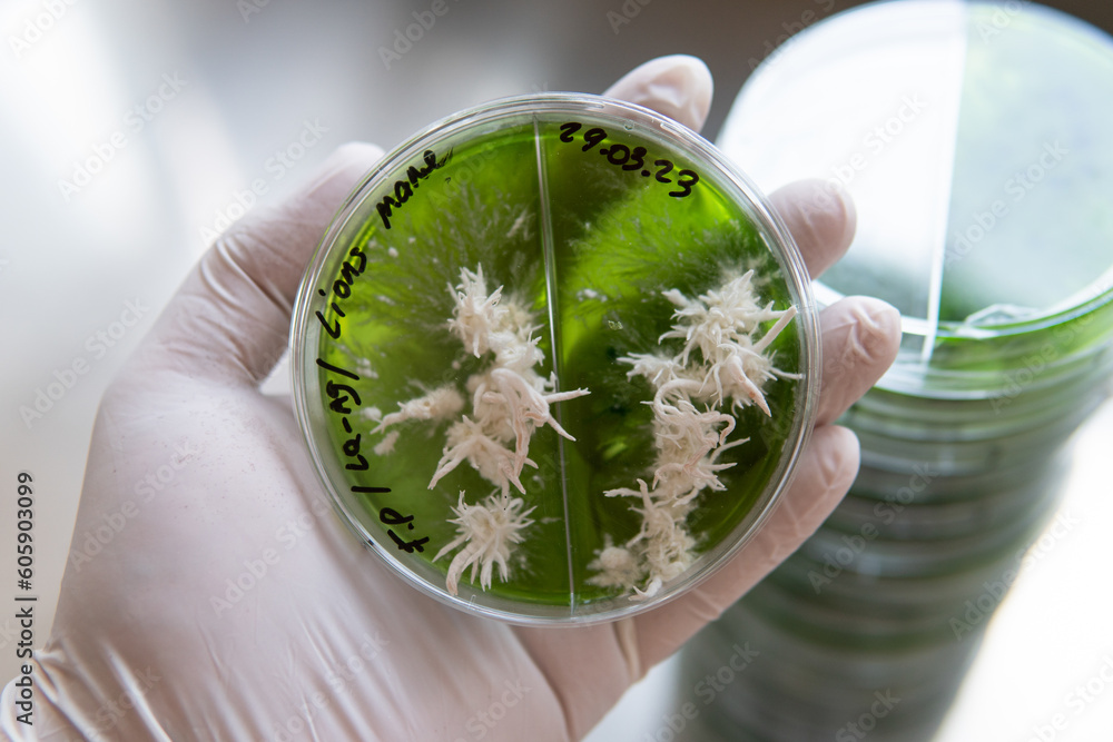 Mycology and conservation of mushroom cultures. Mycelium of the Stock ...