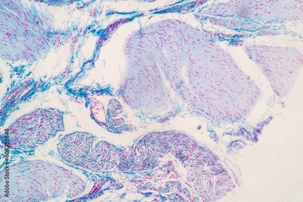 Showing Light micrograph of the Adrenal gland and Urinary bladder human ...