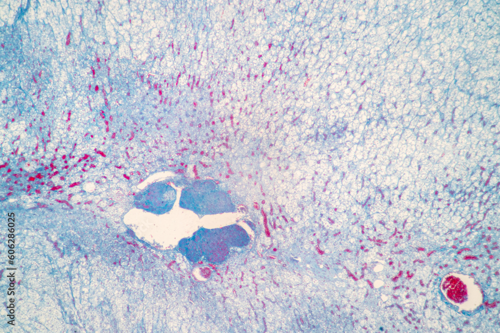 Showing Light micrograph of the Adrenal gland and Urinary bladder human ...
