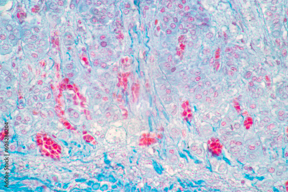 Showing Light micrograph of the Adrenal gland and Urinary bladder human ...