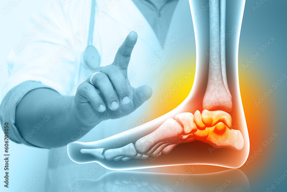 Doctor check and diagnose the ankle injury on medical background. 3d ...