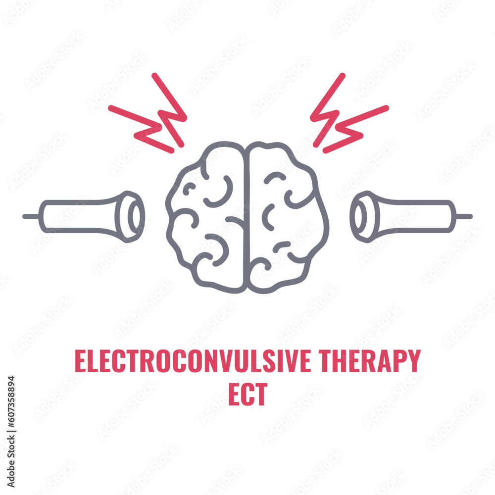 Electroconvulsive therapy for severe depression and schizophrenia ... Electroconvulsive therapy for severe depression and schizophrenia ...