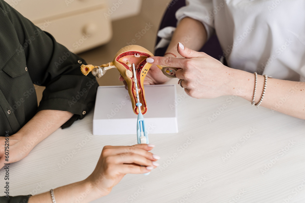 Close-up insert of intrauterine device IUD into your uterus model ... Close-up insert of intrauterine device IUD into your uterus model ...
