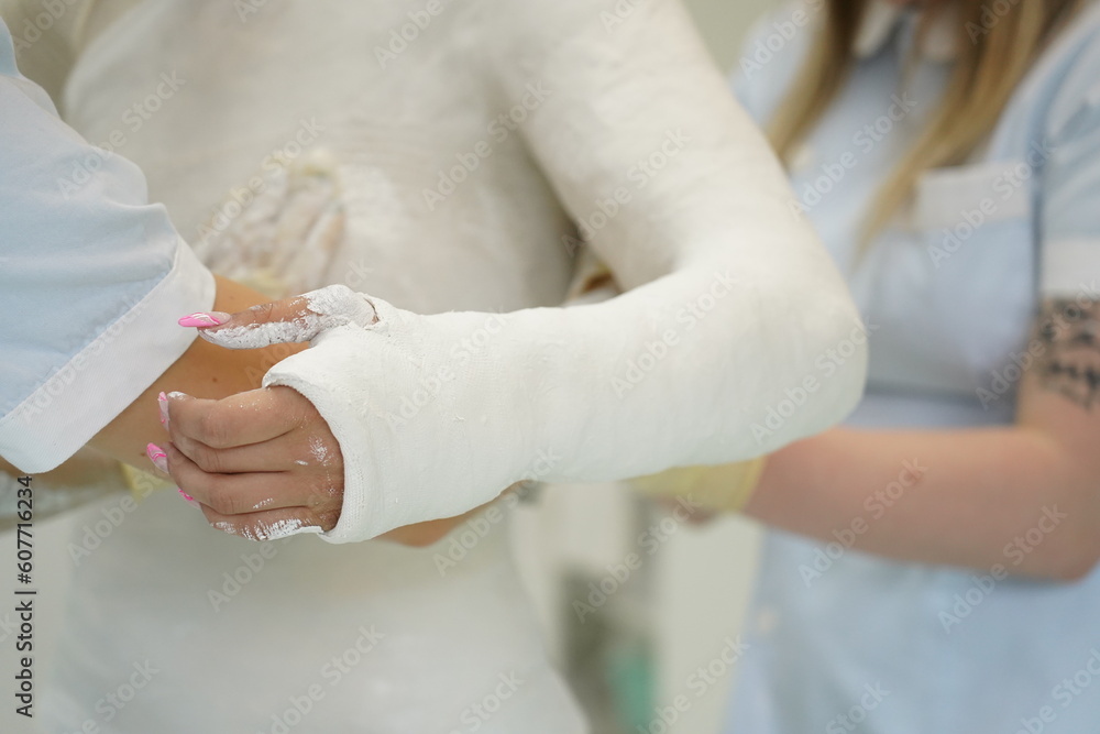 Shoulder Spica Orthopedic Plaster Cast Broken Arm Stock Photo | Adobe Stock