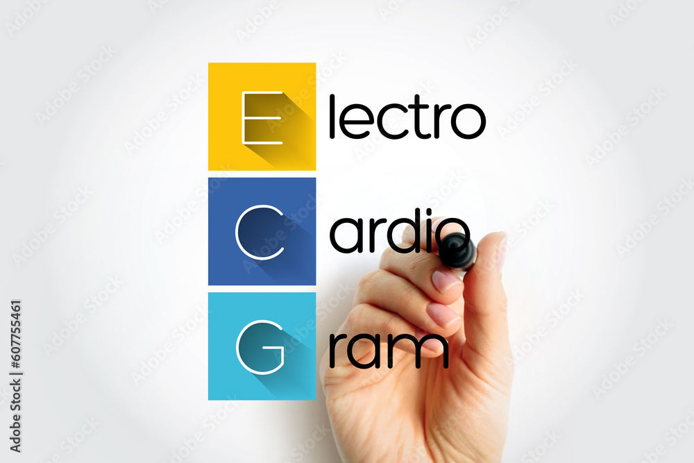 ECG Electrocardiogram - simplest and fastest tests used to evaluate the ...