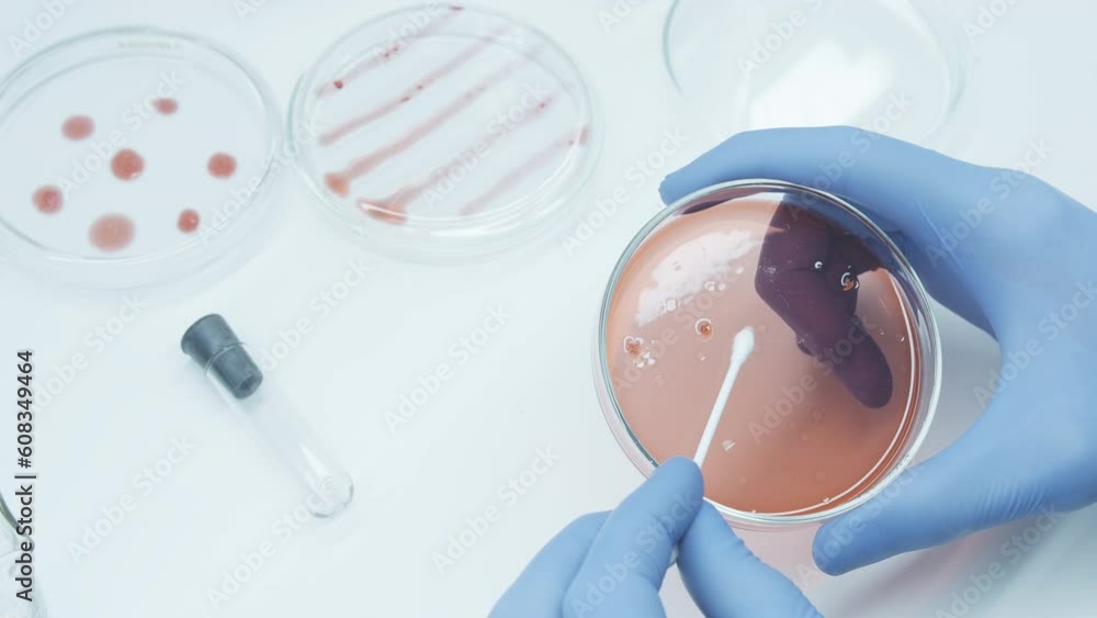 Bacteria culture growth on a petri dish in microbiology lab. Candida ...