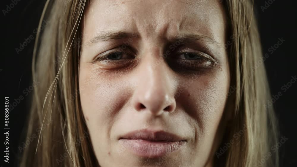 A sad beaten up woman with tear in eye and bruises is crying or ...