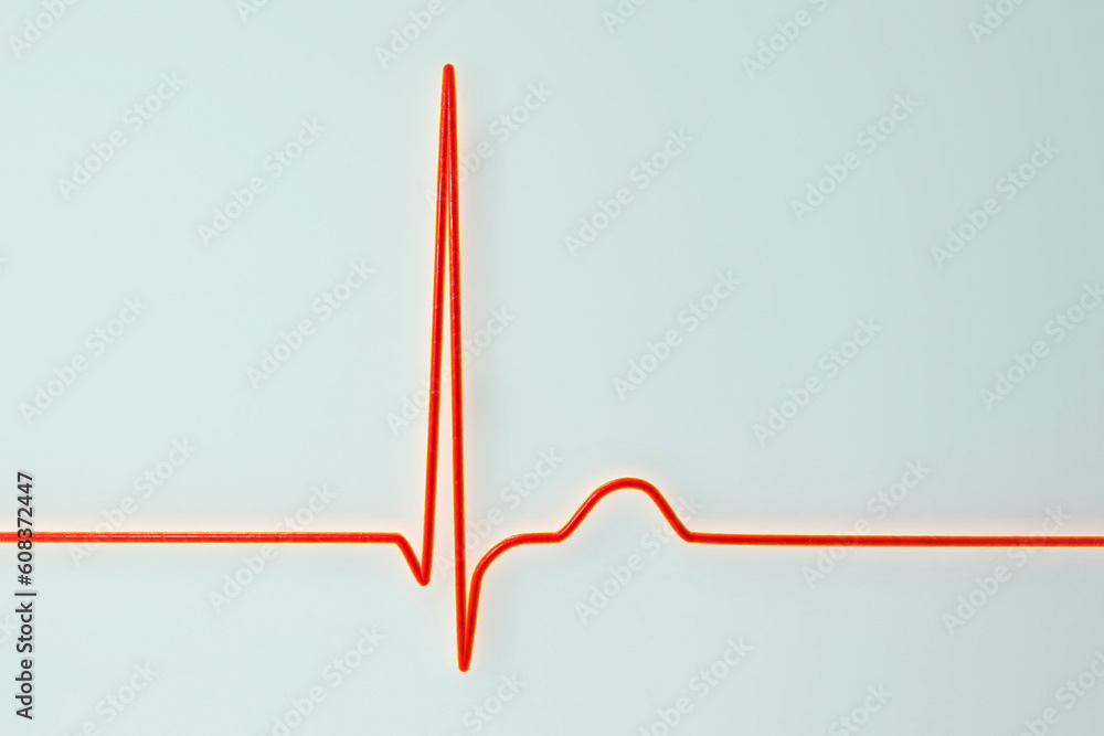 Electrocardiogram ECG displaying a junctional rhythm, 3D illustration ...