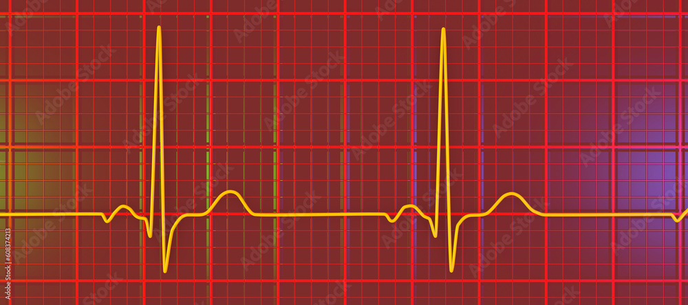 A normal electrocardiogram, 3D illustration displaying the electrical ...