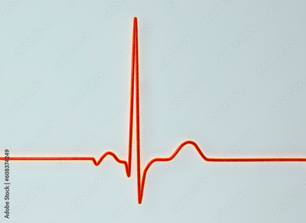 A normal electrocardiogram, 3D illustration displaying the electrical ...