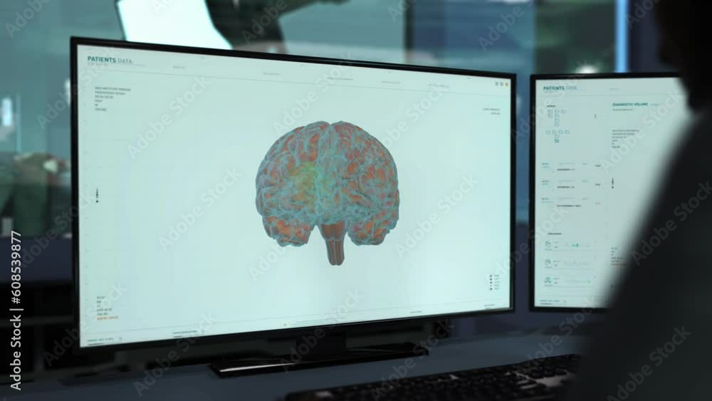 Medical Science X-ray Diagnostic Interface Studying Patient Brain ...