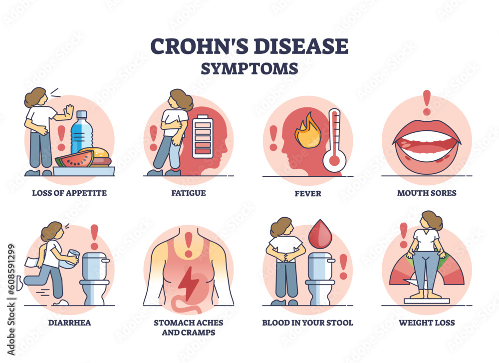 Poster Crohns disease symptoms from inflammatory bowel illness outline ...