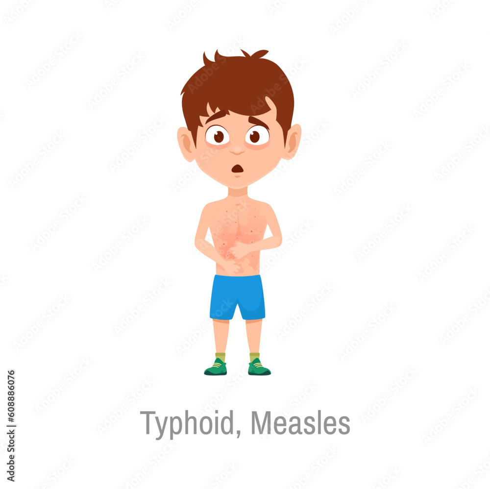 Typhoid measles kid disease. Isolated vector sick boy with red rash on ...