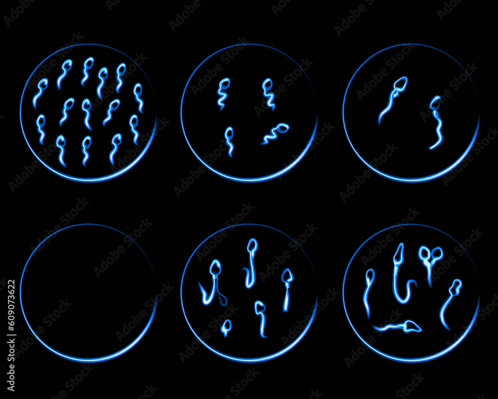 Vector isolated illustration of sperm pathologies. Spermogram. Sperm ...
