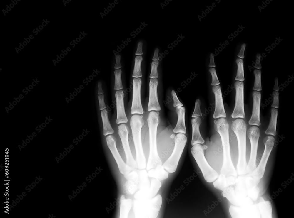 X-Ray Series - illustrations depicting various parts of the human ...