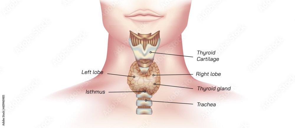Hypothyroidism Vs Hyperthyroidism Healthy And Unhealthy Thyroid Test Thyroid Tumour And