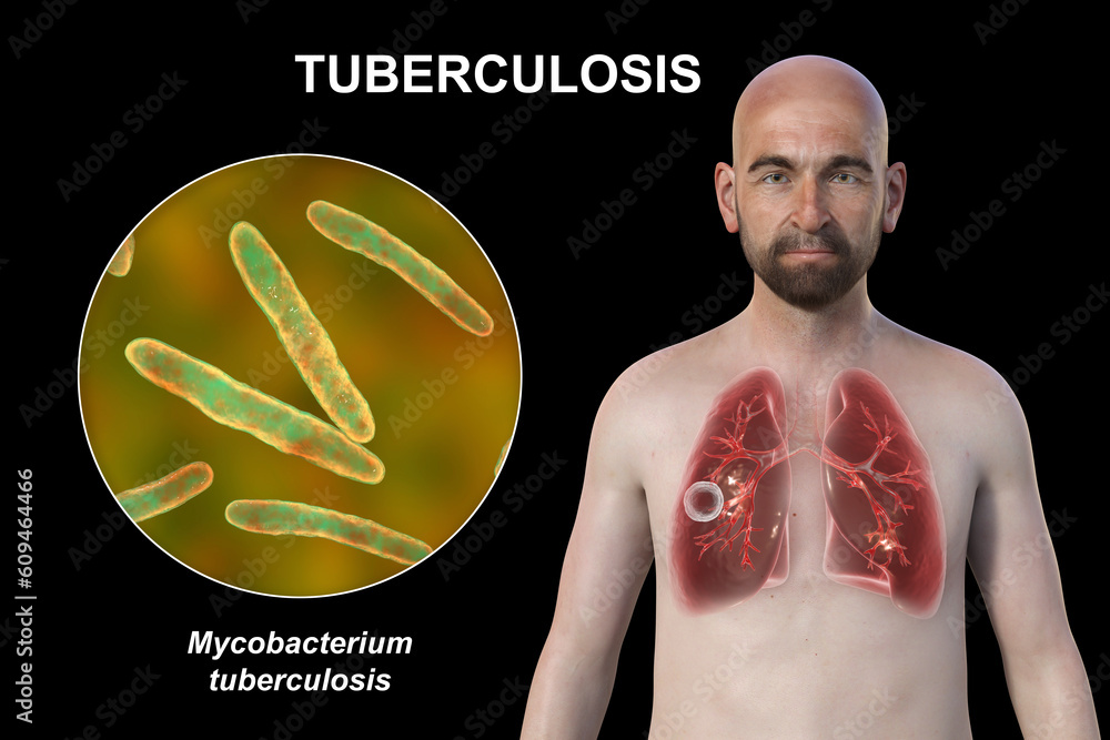 A 3D illustration of a man with transparent skin, showcasing the lungs ...