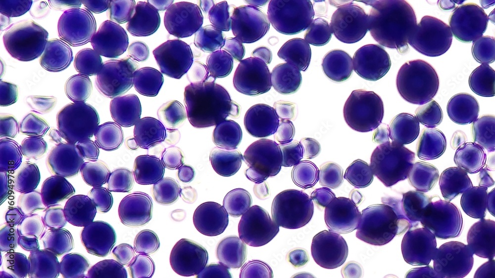 Cassava starch grains under microscope. 1000x magnification, stained by ...