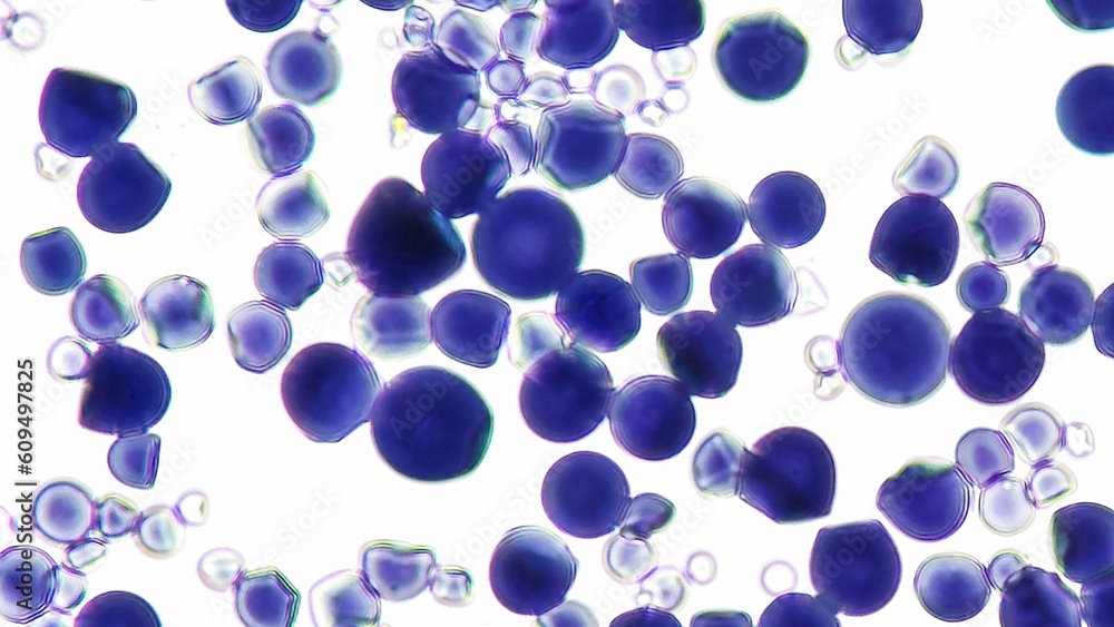 Cassava starch grains under microscope. 1000x magnification, stained by ...