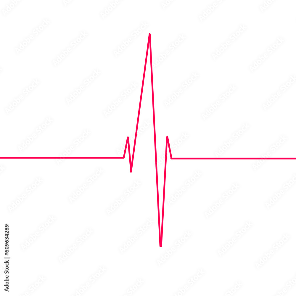 heart rate graph cardiac arrest , heart beat graph Stock Illustration ...