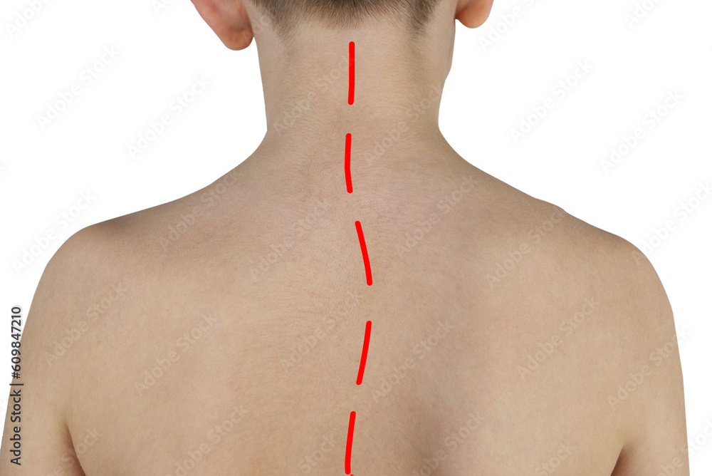 teen pin with crooked spine isolated on white background. Incorrect ...