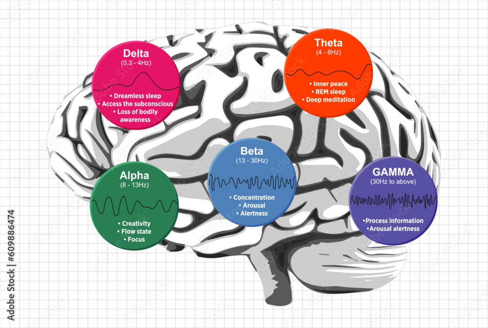 Various waveforms are generated by brain activity as observed in an EEG ...