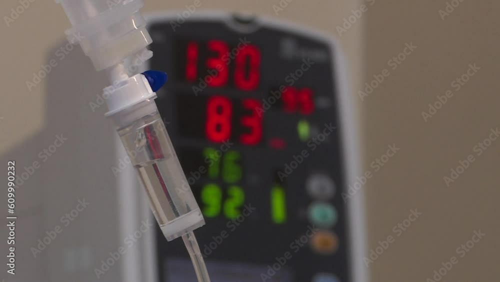 Vidéo Stock IV drip in the surgical operating room. IV drip system for ...
