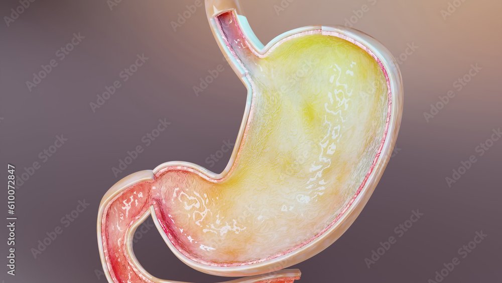 human stomach with gases. Bloating and flatulence, flatulence and ...