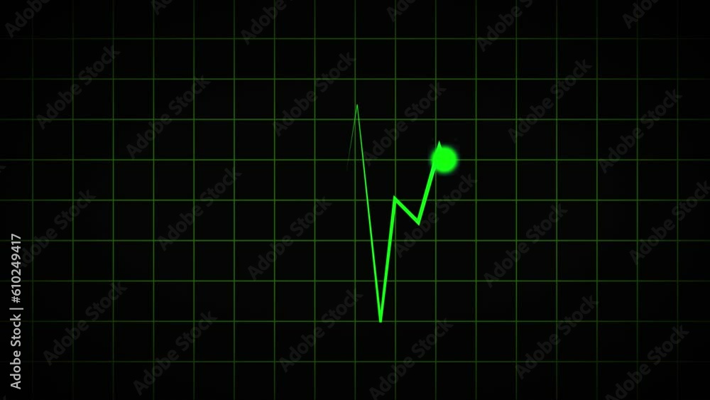Cardiograph monitor showing pulse line with animated heartbeat. EKG 001 ...