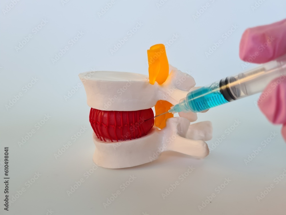 Model of the human spine on in doctor uses a syringe to make an ...