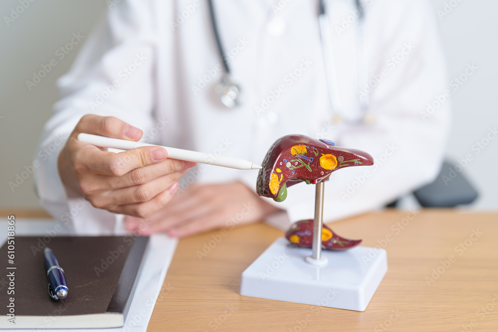 Doctor with human Liver anatomy model. Liver cancer and Tumor, Jaundice ...
