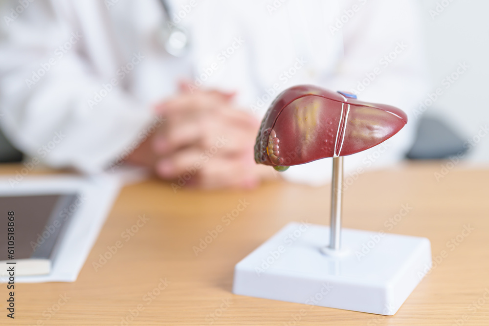 Doctor with human Liver anatomy model. Liver cancer and Tumor, Jaundice ...