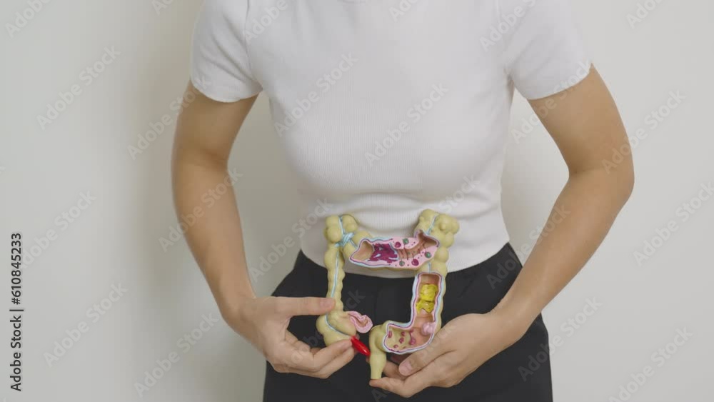Woman holding human Colon anatomy model. Colonic disease, Large ...